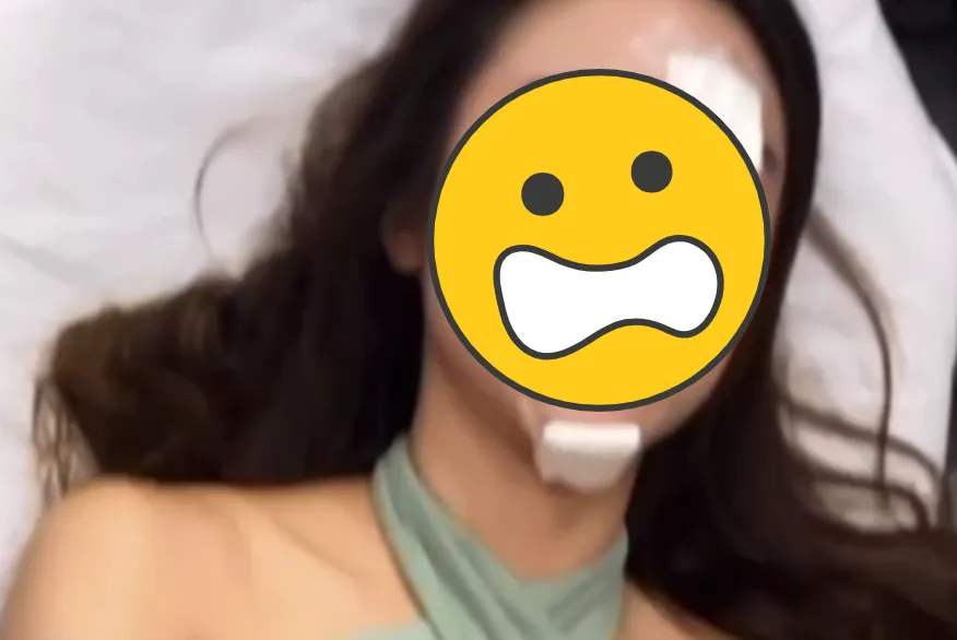 J2女神黃紫恩街上突暈倒「正臉撞水泥地」！曝驚人傷勢：撿回一條命 | am730