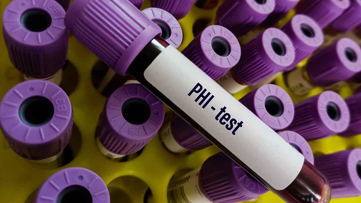 檢測PSA惹來的煩惱 | am730