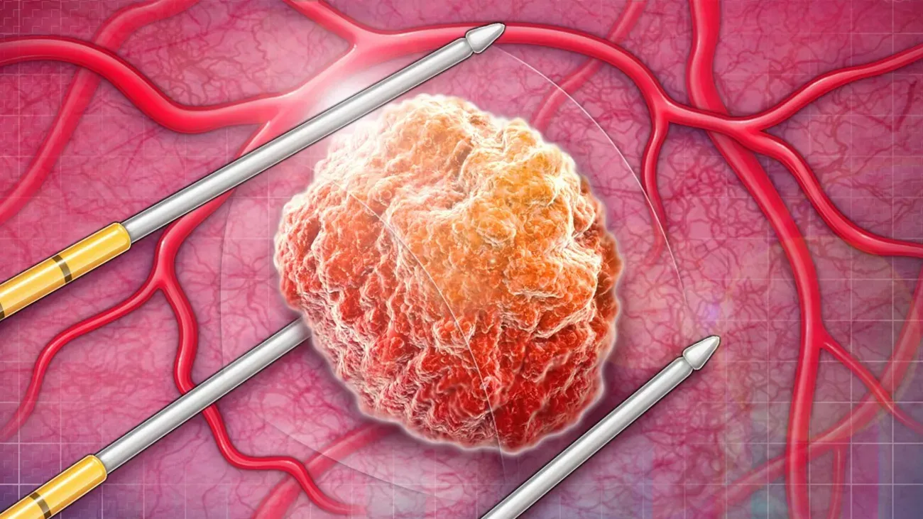 前列腺切片 非100%準確 | am730