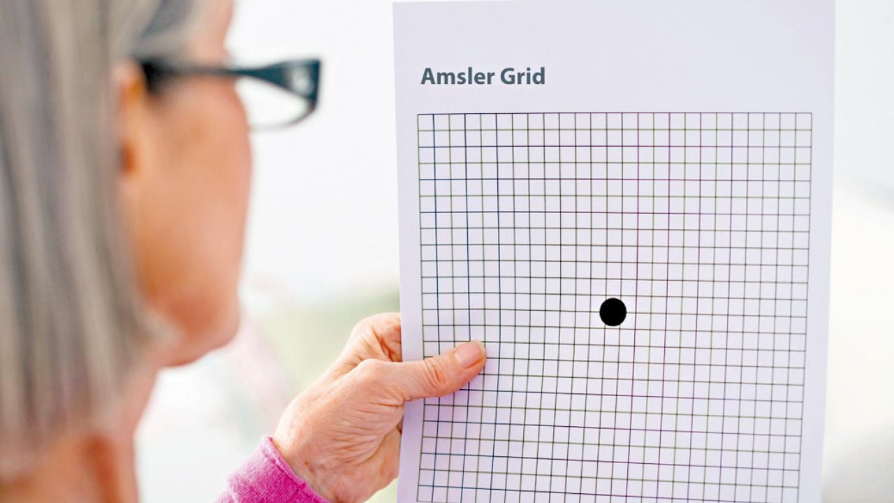 你我都有黃斑點 | am730