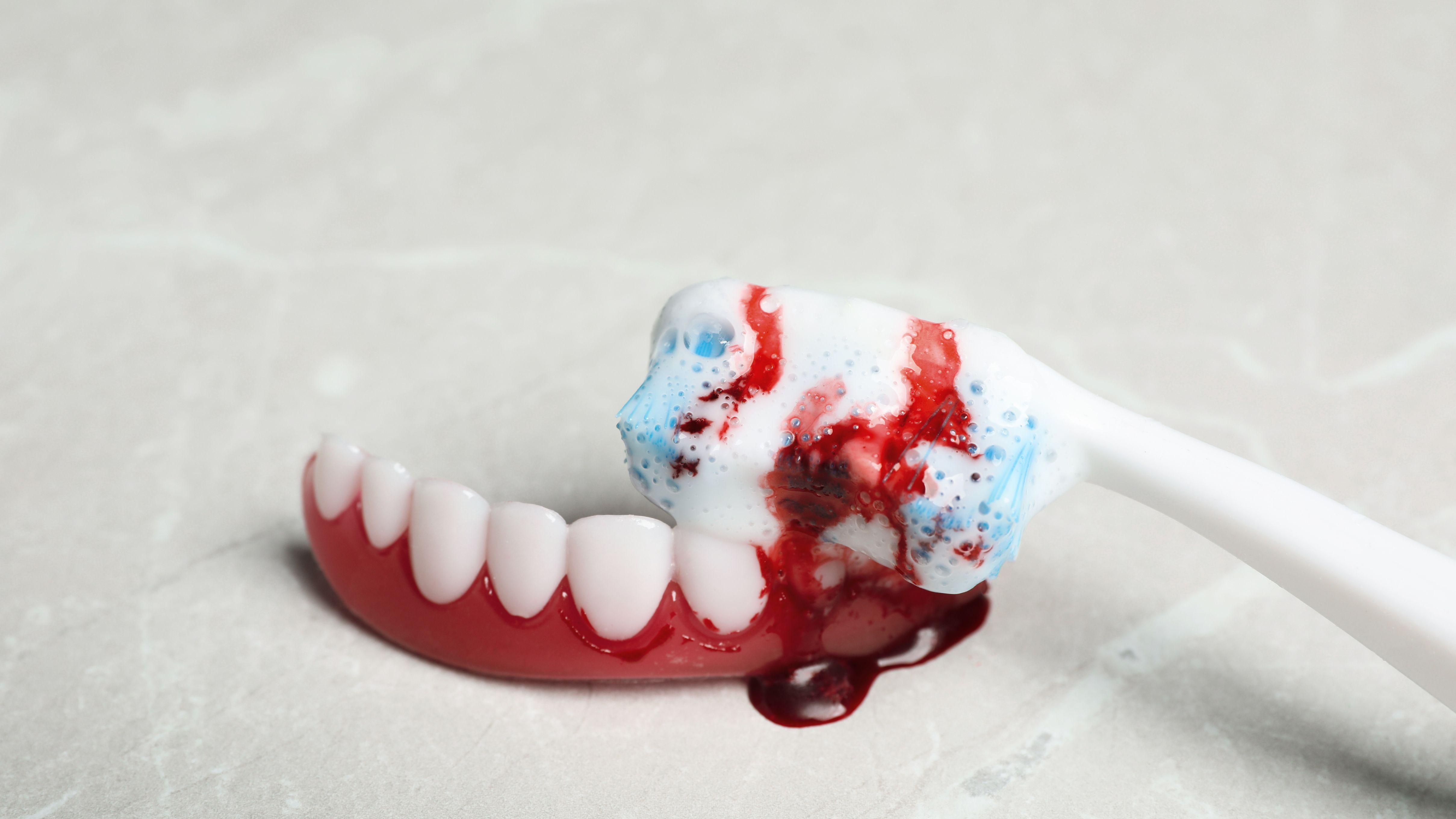 Bleeding Gums While Brushing: Elevated Stroke Risk and Essential Oral ...
